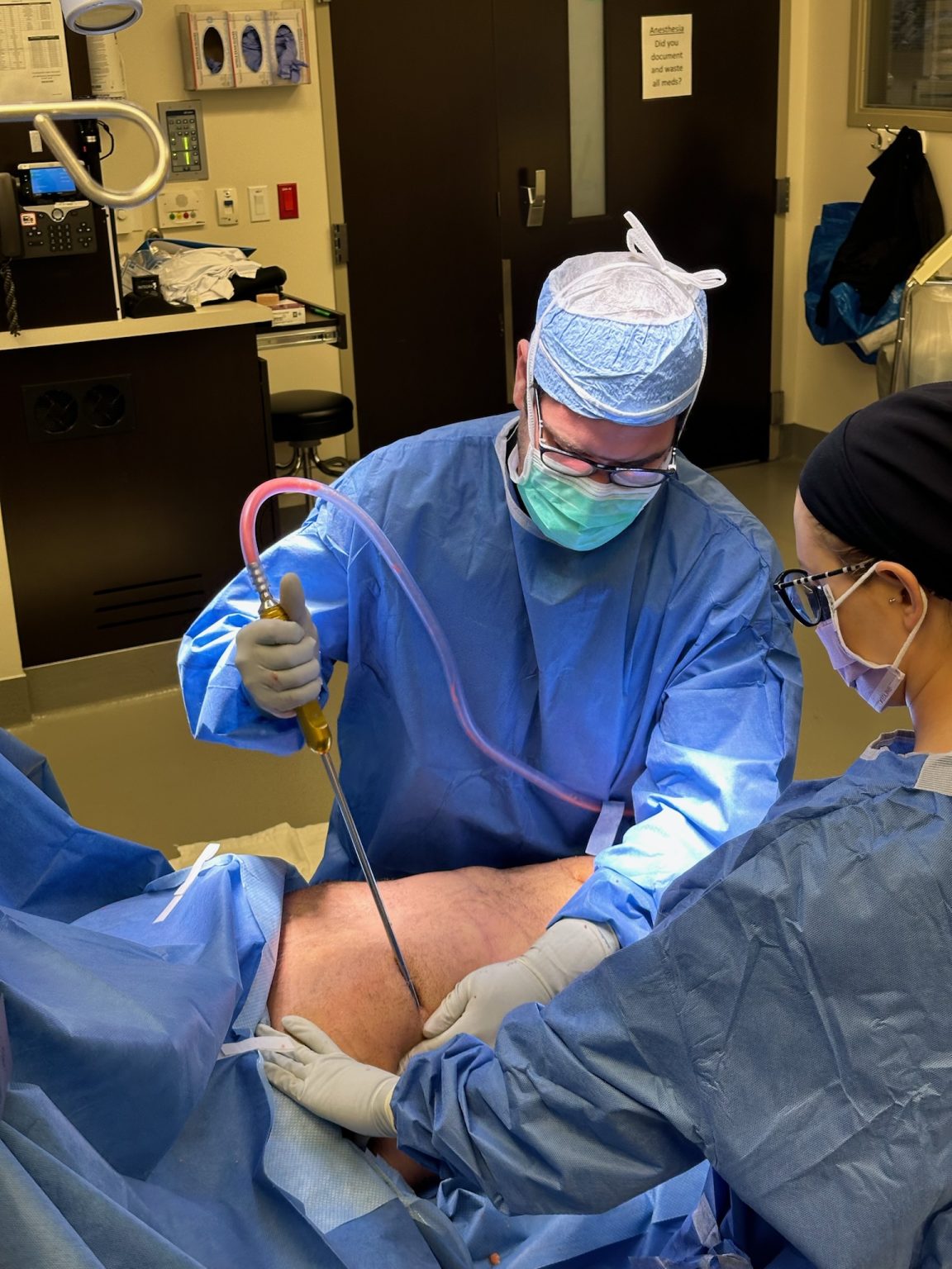 Pros y contras de los diferentes tipos de liposucción | Dallas, TX